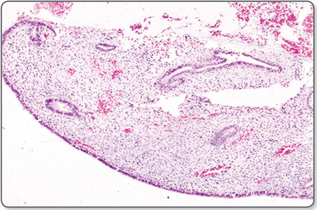 Lower Uterine Segment Histology