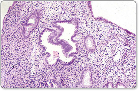 Lower Uterine Segment Histology