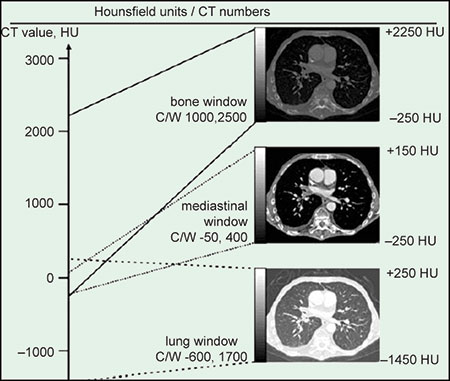 Ct Scanner Schematic