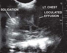 JaypeeDigital | eBook Reader