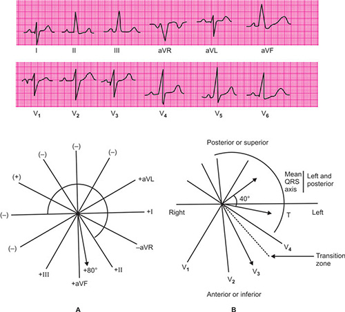 Heart Vector Axis