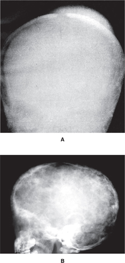 Normal Lateral Skull Radiograph Buyxraysonline NERS/BIOE 481 Gallery