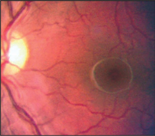 JaypeeDigital | eBook Reader