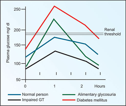 Figure From VARIANTS OF ORAL GLUCOSE TOLERANCE TEST (OGTT), 55% OFF