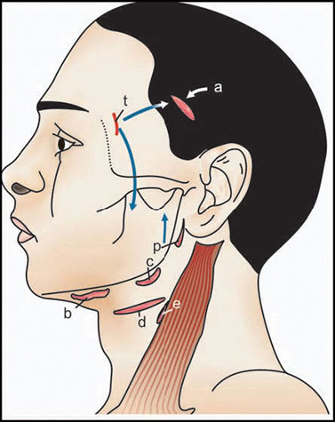 Infraorbital Space Infection