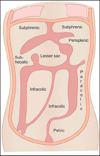 Subphrenic Space Anatomy