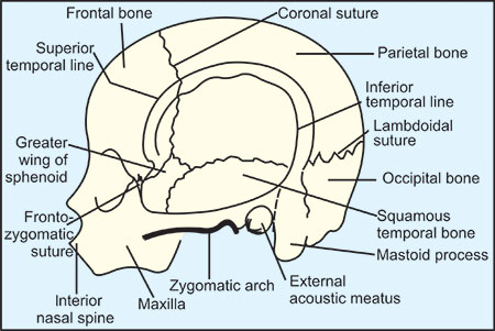 Inferior Temporal Line