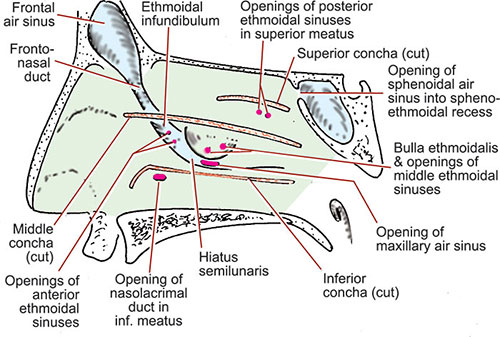 Ethmoidal Infundibulum And Frontonasal Duct