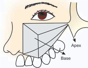 상악동 저류낭종(maxillary sinus retention cyst) : 네이버 블로그