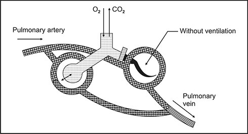 Physiological Shunt Bronchial Circulation