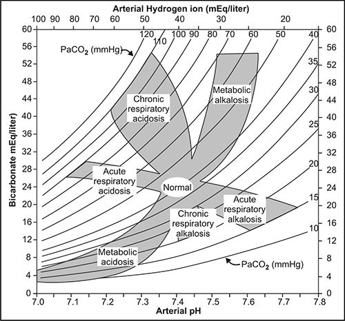Acid Base Nomogram Development Of A Nomogram For Predicting