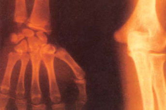 JaypeeDigital | eBook Reader