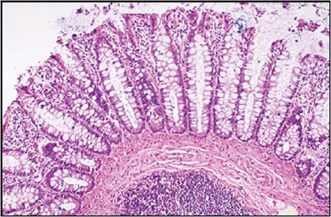 Large Intestine Histology Labeled