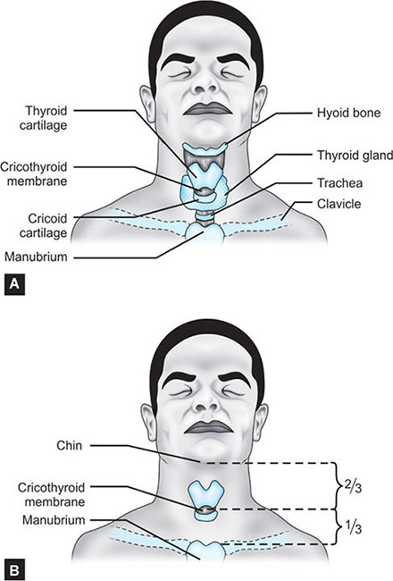 Cricoid Brusk Anatomi Lower Border Of The Cricoid Cartilage Is An
