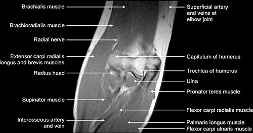 Elbow Anatomy Muscles Mri