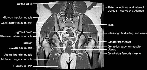 Obturator Externus Mri Anatomy