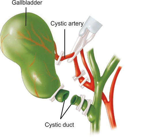 Cystic Artery Gallbladder