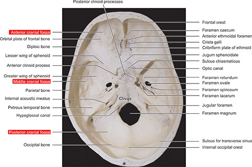 Foramen Lacerum Temporal Bone