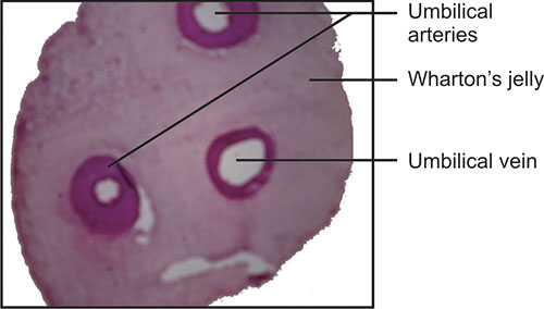 Umbilical Cord Cross Section Histology