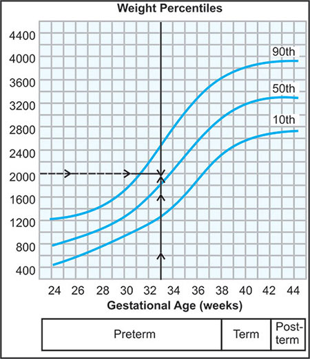 Preterm Infant Growth Chart Using The New UK WHO Growth Charts