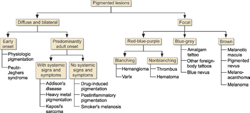 Top more than 126 amalgam tattoo differential diagnosis best ...