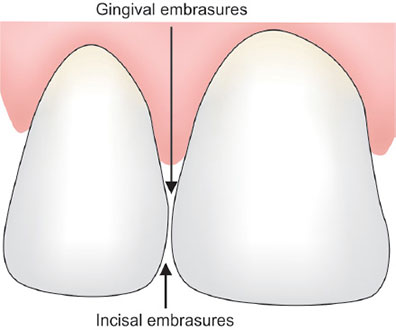 Gingival Sulcus Pronunciation