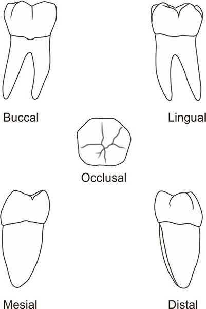 Maxillary Molars Diagrams Dental Anatomy: Maxillary Molars YouTube