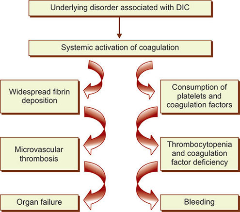 Disseminated Intravascular Coagulation Pathophysiology