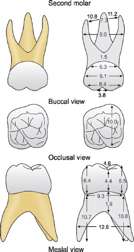 Primary Maxillary Second Molar
