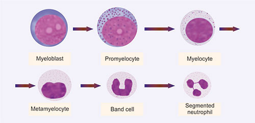 Band Vs Segmented Neutrophils Blood Film