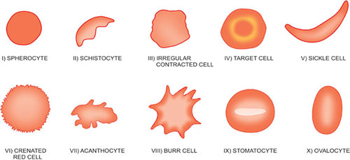 Ovalocytes 1-meaning Red Blood Cell Morphology, Size, Shape, Color