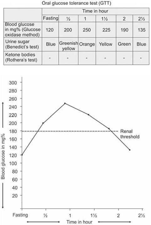 Glucose Tolerance Test Chart
