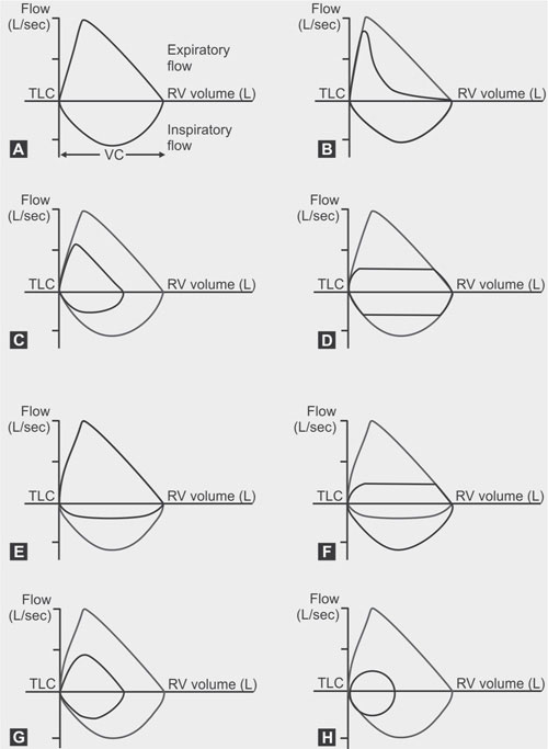 JaypeeDigital | eBook Reader
