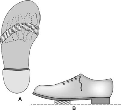 Thomas Heel Orthotics
