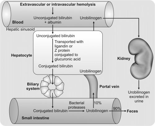 Neonatal Jaundice Pathophysiology Flow Chart