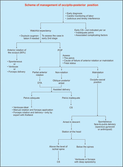 Contracted Pelvis Diagnosis