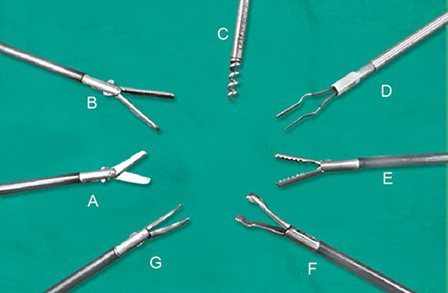 Laparoscopic Tubal Ligation Instruments