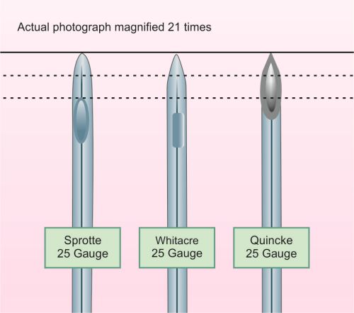 Lumbar Puncture Needle Size With Colour