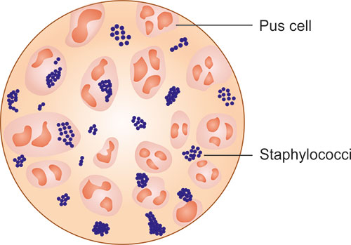 Staphylococcus Aureus Morphology Diagram