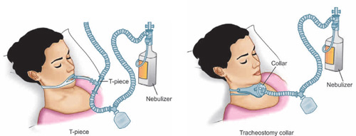 Tracheostomy Collar And T Piece