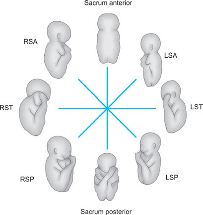 Fetal Presentations Ac Breech Sacral Presentation D