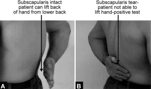 Gerber Lift Off Test
