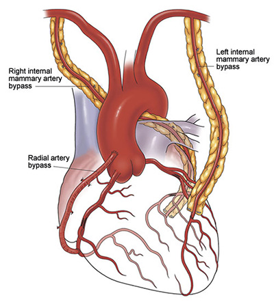 Lima Artery Anatomy JaypeeDigital | EBook Reader
