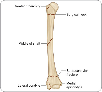 Gluteal Tuberosity Pronunciation