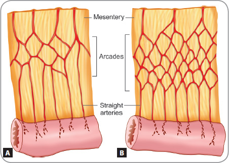 Jejunum Vs Ileum Arcade