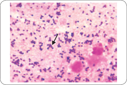 Staphylococcus Saprophyticus Gram Stain