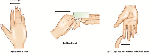 Egawa Test #ulnar #dorsal #interossei Median Nerve, Ulnar, 44% OFF
