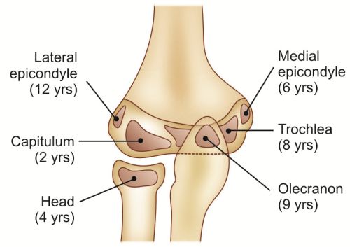 Lateral Condyle Epicondyle