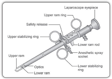Laparoscopic Tubal Ligation Instruments