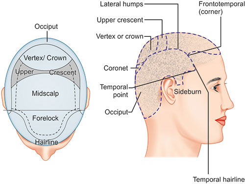 Defining The Three Central Scalp Zones And Their